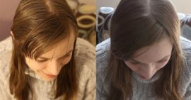 Amazing What Happens When You Stop Using Shampoo For 31 Days All For