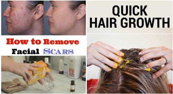 Seven Ways To Get Rid Of The Biggest Beauty Problems That Every Woman ...