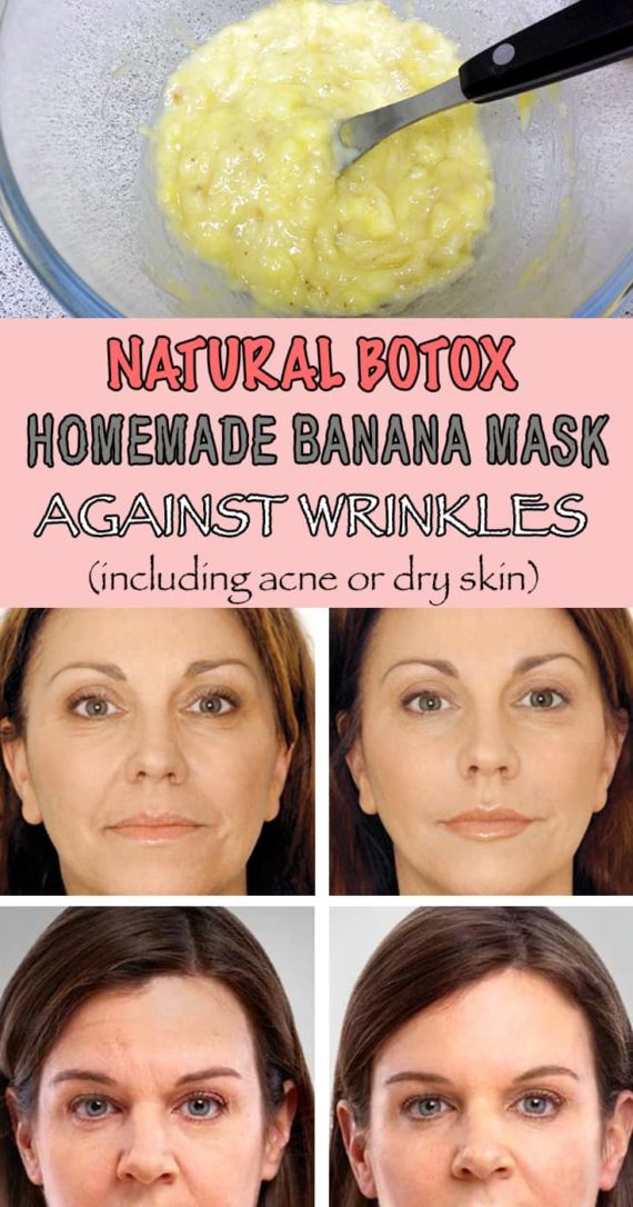 Homemade Botox Recipes That Will Make You Look Younger All For