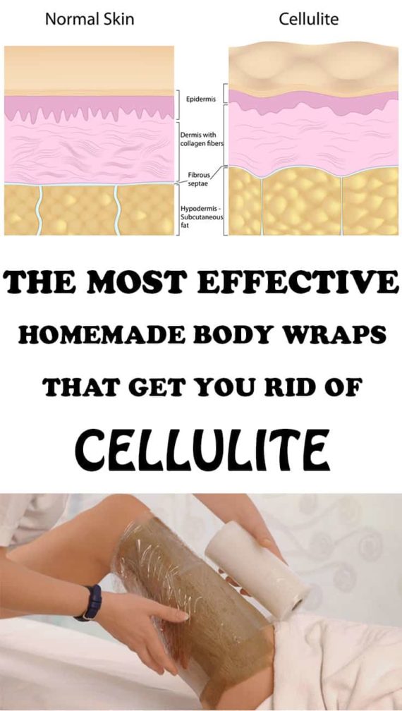 The Biggest Skin Problems And Natural Ways To Get Rid Of Them - ALL FOR ...