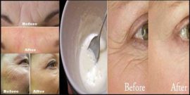The Best Homemade Anti-Wrinkle Creams That You Have To Try Now - ALL ...