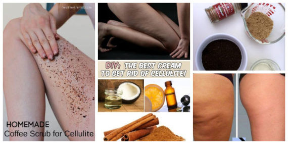 Homemade Anti-Cellulite Treatments That Are Really Effective - ALL FOR FASHION DESIGN